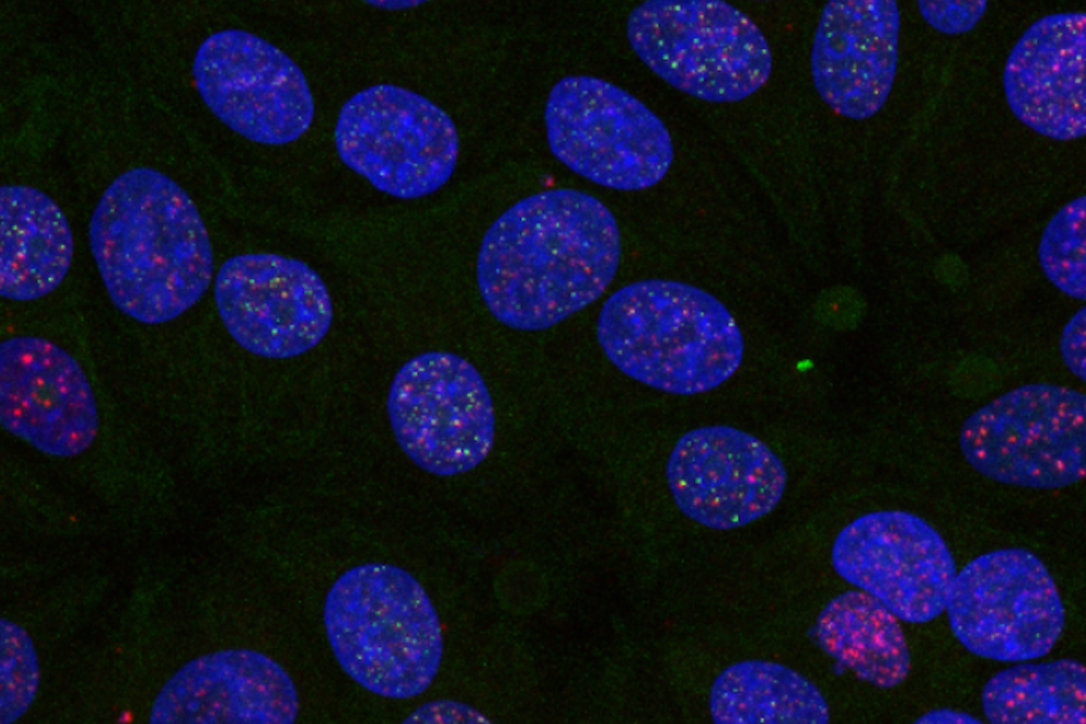 Lifeguard on Duty: Looking at DNA Repair under a Microscope | Gerstner ...