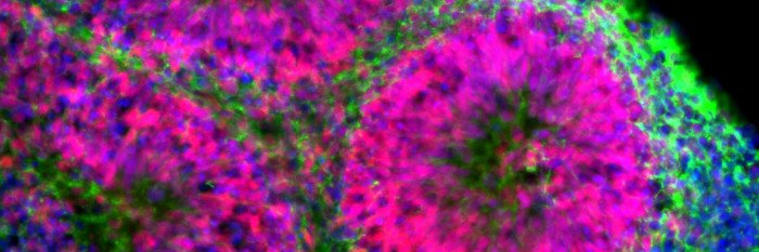 Lorenz Studer: Featured News | Sloan Kettering Institute