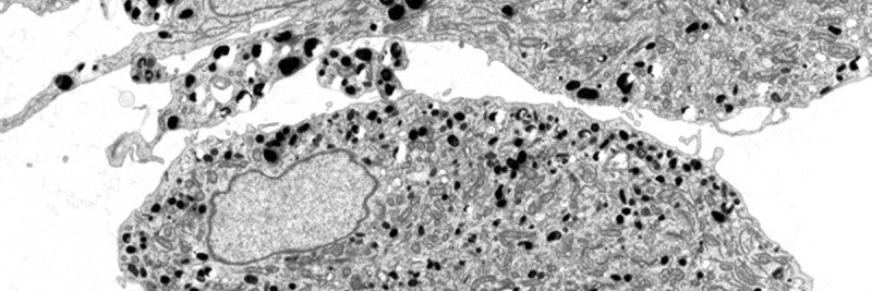 Why Are Only Some Cells ‘Competent’ to Form Cancer? MSK Scientists Say ...